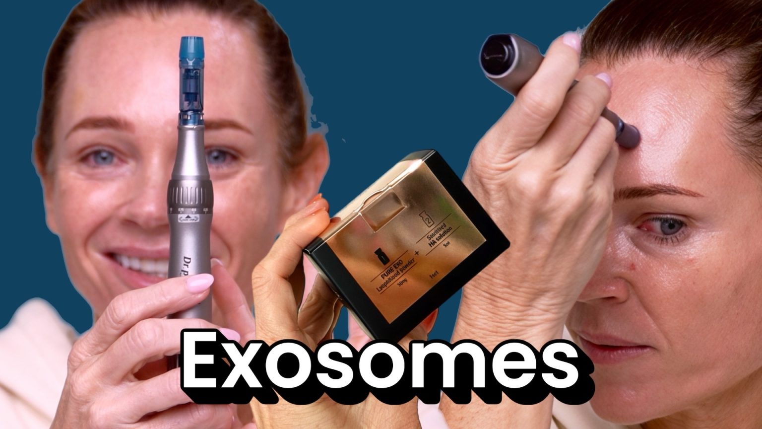 Microneedling With Exosomes for Fine Lines and Wrinkles - Natural Kaos